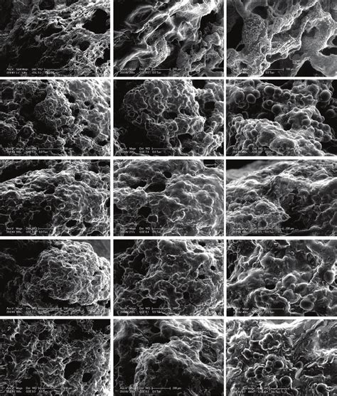 Microstructure Of Mp Emulsion Composite Gels Esem Magnification ×100 Download Scientific