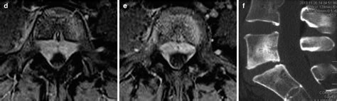 Differential Diagnosis Radiology Key