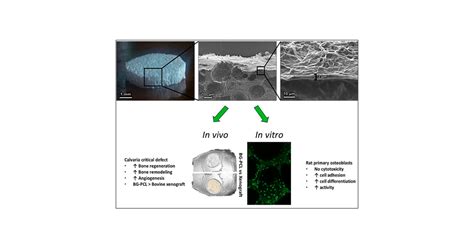Bioactive Glass Polycaprolactone Hybrid With A Dual Cortical Trabecular Structure For Bone