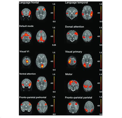 Example Resting State Networks Obtained By Seed Based Functional Download Scientific Diagram