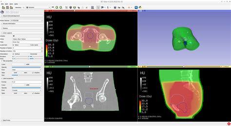 Display Colour Legend For Surface Development 3d Slicer Community