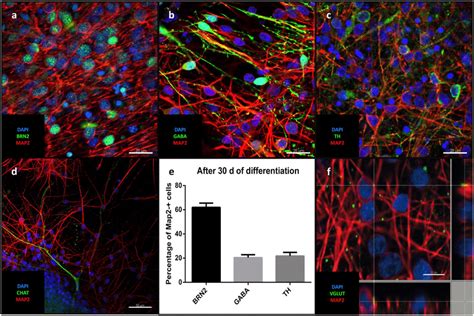 Neuronal Identity After Differentiation Representative Confocal Images Download Scientific