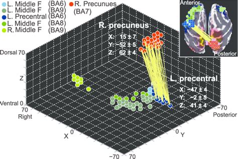 Functional Connectivity For Incorrect Temporal Orientation In The Main Download Scientific