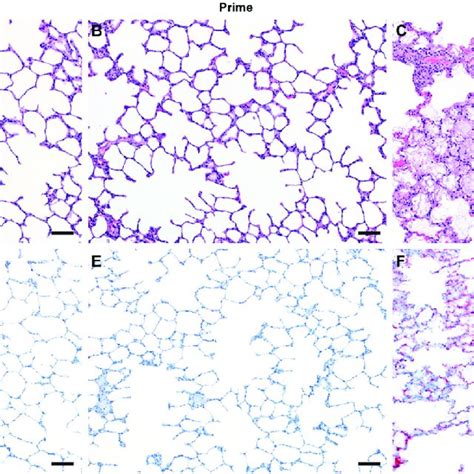 Pulmonary Effects Of Chadox1 Niv Vaccine Efficacy In The Agm Model Of