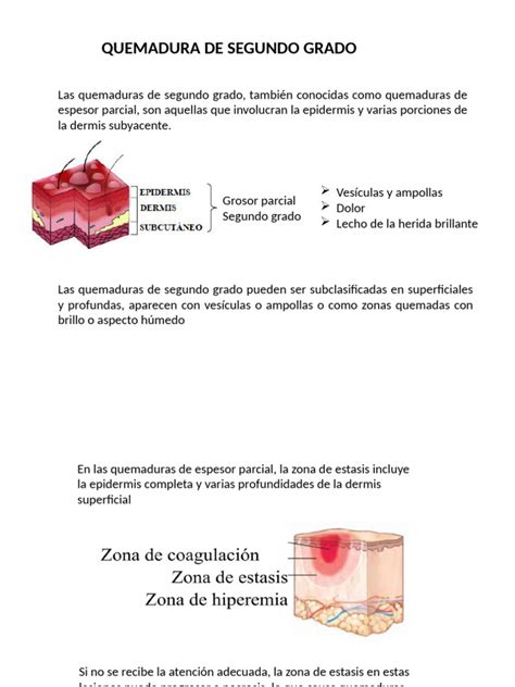 Quemadura De Segundo Grado Slide Blanco Pdf