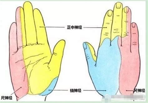 手麻不都是颈椎病———肘管综合征 知乎