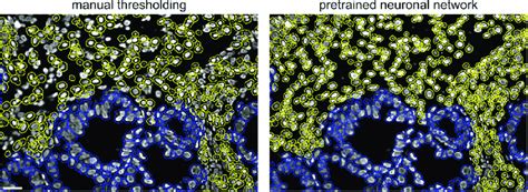 Nuclei Segmentation Options Nuclear Segmentation Based On Manual Download Scientific Diagram