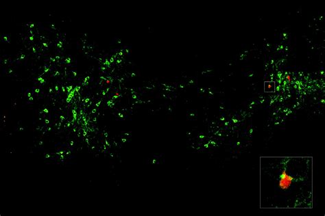 Dopamine Signals When A Fear Can Be Forgotten Mit News