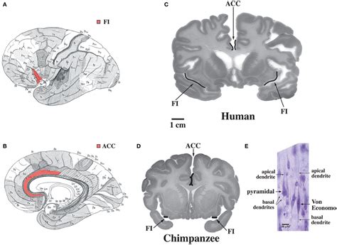 Anterior Cingulate Cortex