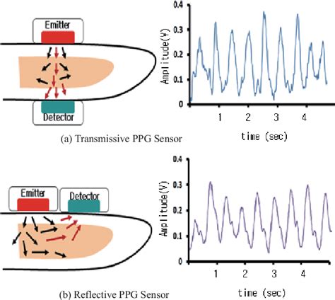 figure 4 from motion artifacts reduction from ppg using cyclic moving