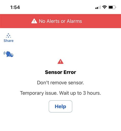 Sensor Error R Dexcom