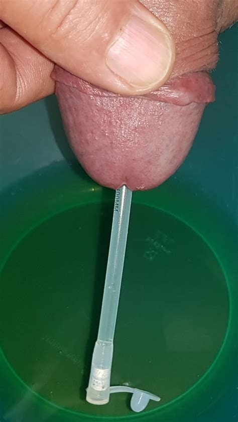 Catheter Insertion 111 Pics Xhamster Catheter Insertion 111 Pics Xhamster