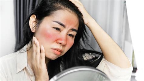 Do You Get Itchy Swollen Red Rashes When Youre Outside You May Have A Case Of Sun Allergy