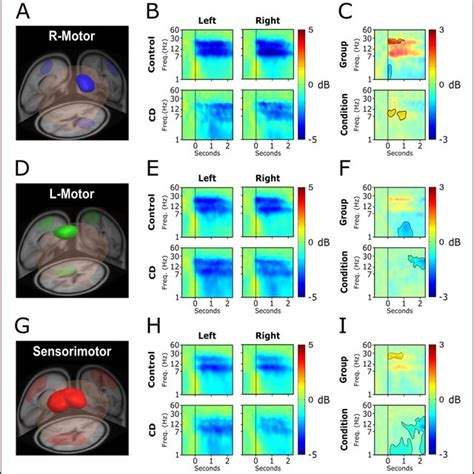 EEG Analysis Results We Show The Location And Size Of The Motor And Download Scientific