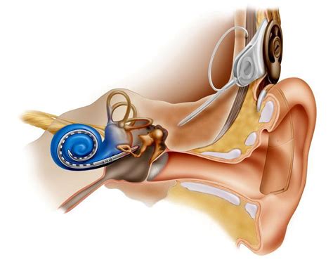 Як отримати слуховий апарат безкоштовно державні послуги для людей із порушеннями слуху