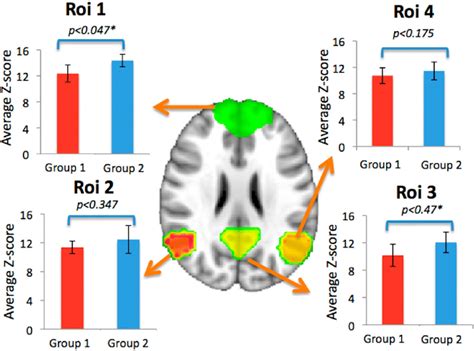 Resting State Default Mode Network Regions And Corresponding Average Download Scientific