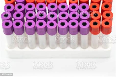 흰색 바탕에 환자에서 혈액 튜브 샘플 공간 공간 텍스트와 이미지를 복사 합니다 의료 장비 0명에 대한 스톡 사진 및 기타 이미지 Istock