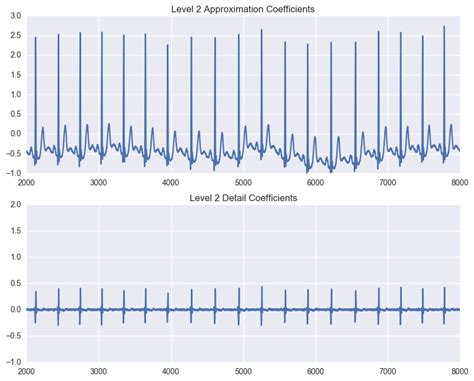 Electrocardiograms Qrs Detection Using Wavelet Analysis By Andrew
