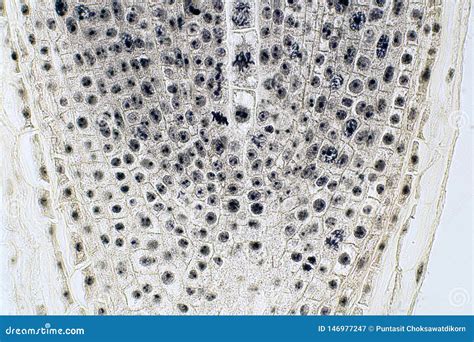 Root Tip Of Onion And Mitosis Cell In The Root Tip Stock Image Image Of Mitotic Membrane