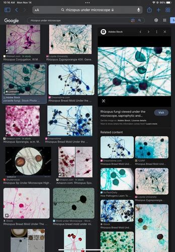 Fungi Lab Flashcards Quizlet Fungi Lab Flashcards Quizlet