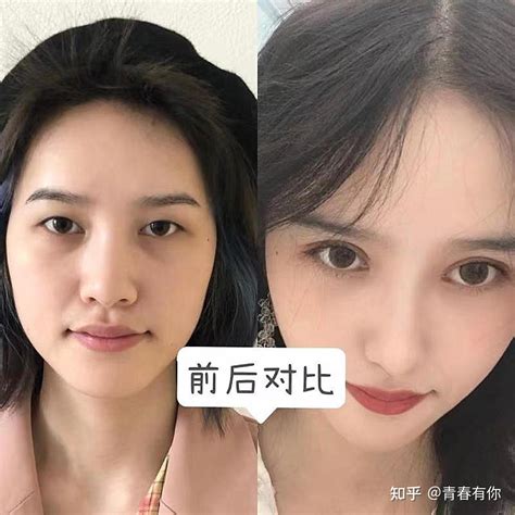 广州哪个割双眼皮的整形医院比较好有没有割过的朋友介绍一下双眼皮手术后效果好不好看双眼皮手术做的好的医生有没有推荐 知乎