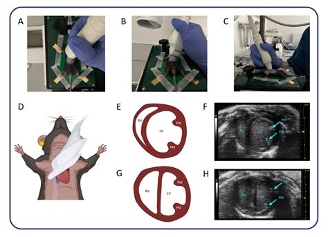 A Murine Model Of Pressure Overload Induced Right Ventricular