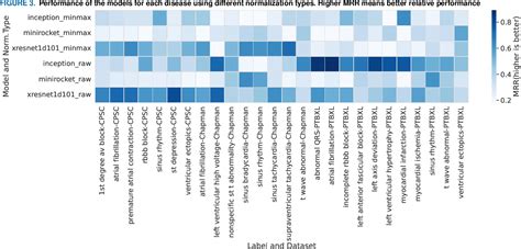 Exploring Best Practices For Ecg Signal Processing In Machine Learning