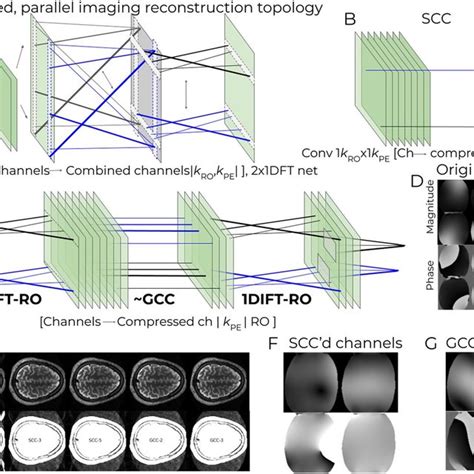 A Basic Subsampled Parallel Imaging Reconstruction Network B