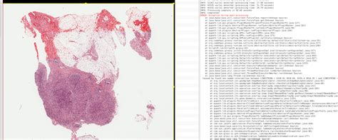 Cell Detection Over Tiled Regions Fails On Some Images · Issue 459 · Qupath Qupath · Github