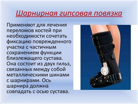 Гипс. Основные виды гипсовых повязок - online presentation