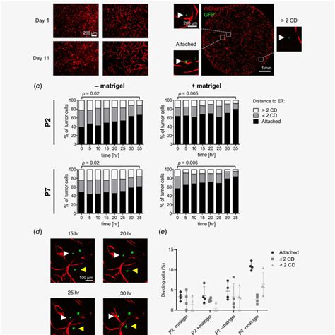 Disseminated Tumor Cells Dtcs Localize Independently From