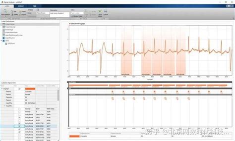 使用matlab实现信号处理的深度学习 知乎