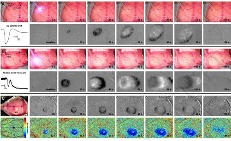 Figure 1 From Real Time Non Invasive In Vivo Visible Light Detection Of Cortical Spreading