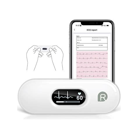 Duoek S Personal Ecg Monitor Bluetooth Wireless Portable Heart Monitor