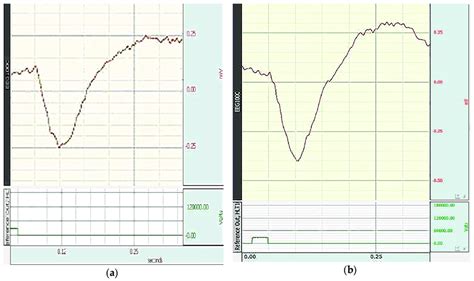 Electroretinogram Of Rat With The Simulated Retinal Download