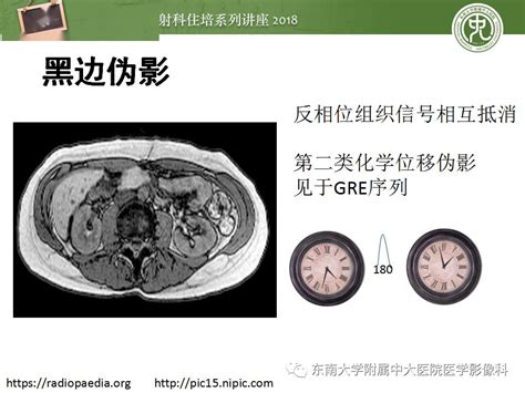 中大放射住培系列讲座磁共振成像常见伪影 郑孝飞