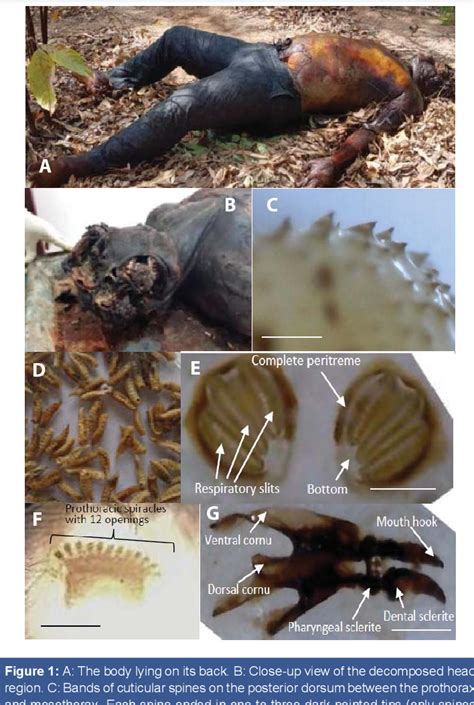 Figure 1 From Estimating Minimum Post Mortem Interval In A Nigerian Murder Case Using Chrysomya