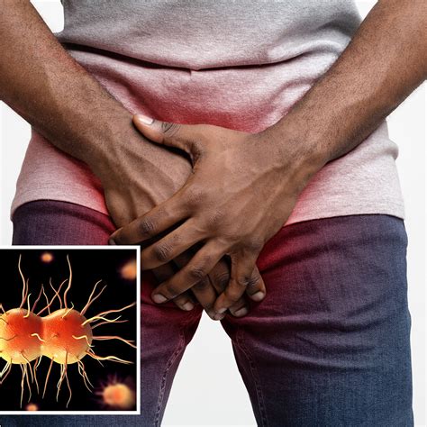 Gonorrhea In Men