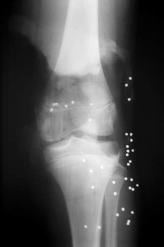 Lecture 1 Radiology Flashcards Quizlet
