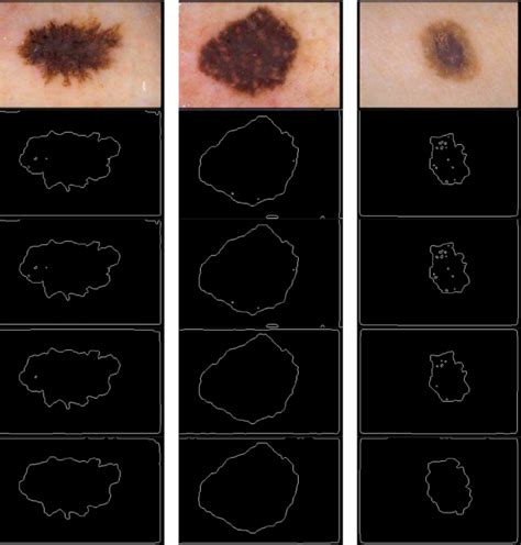 Border Detection Of Exemplar Segmented Images Row Original Images Download Scientific