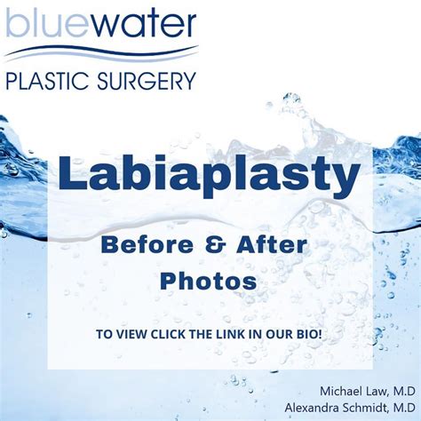 Labiaplasty Before And After