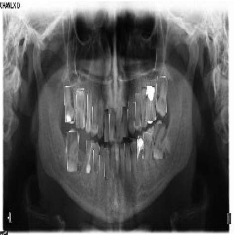 Gv Black Classification Classification Dataset By Minor Project