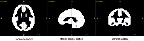 Figure 1 From Individual Level Fmri Segmentation Based On Graphs Semantic Scholar