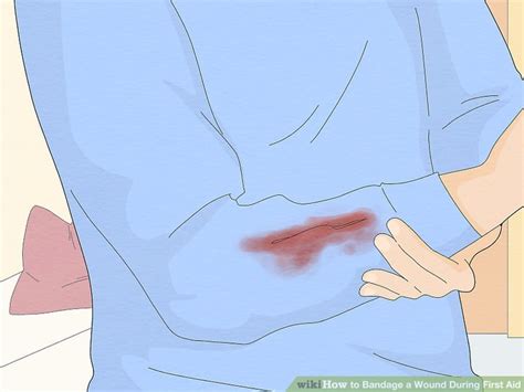 How To Bandage A Wound During First Aid Stopping Bleeding Infection
