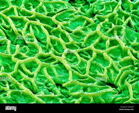 Gallbladder Surface Coloured Scanning Electron Micrograph Sem The Columnar Epithelium Of The