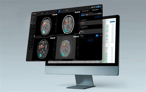 Quibim A Startup Using Ai Imaging To Aid In Disease Detection Raises 50m Siliconangle