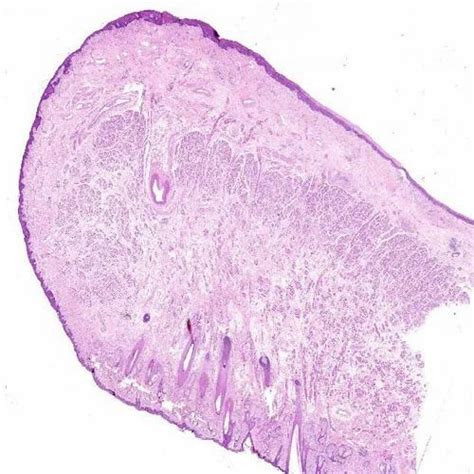 Lip Anatomy Histology At Wallace Swindler Blog