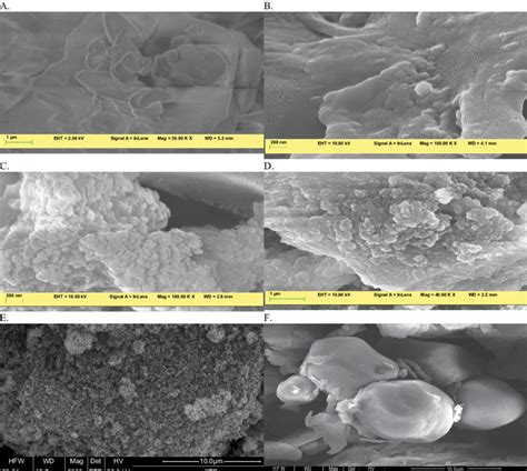 Sem Images A Pure Drug B Solid Sedds F1 C Solid Sedds F9 D Solid Download Scientific