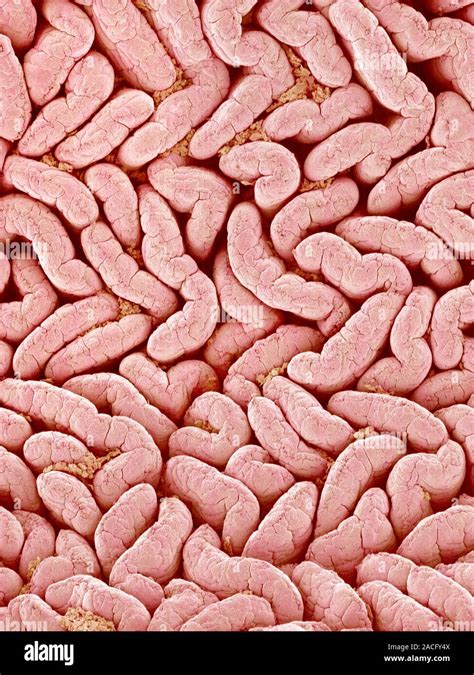 Intestinal Lining Coloured Scanning Electron Micrograph Sem Of Villi From The Small Intestine