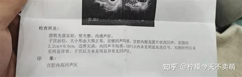 药流残留22×06，14天干净 知乎